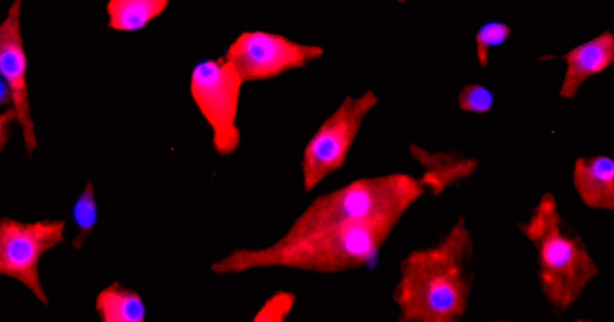 FSU researchers show potential of new treatment for pediatric brain ...